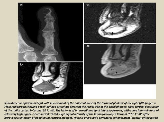 Presentation1.pptx, radiological imaging of soft tissue masses of the ...