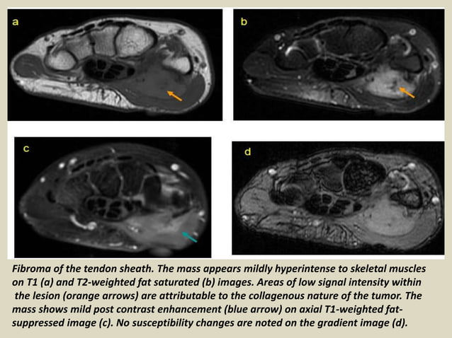 Presentation1.pptx, radiological imaging of soft tissue masses of the ...