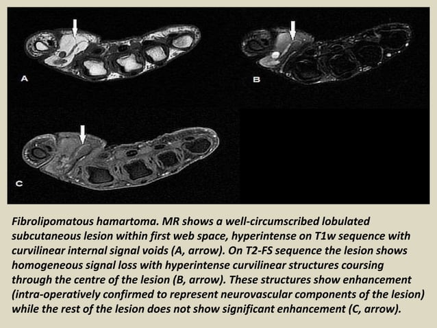Presentation1.pptx, radiological imaging of soft tissue masses of the ...