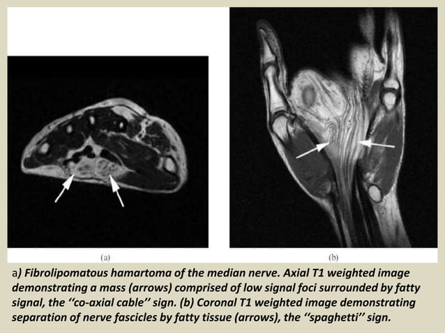 Presentation1.pptx, radiological imaging of soft tissue masses of the ...