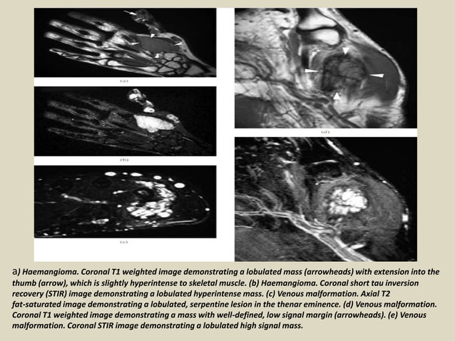Presentation1.pptx, radiological imaging of soft tissue masses of the ...