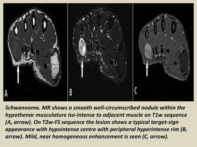 Presentation1.pptx, radiological imaging of soft tissue masses of the ...