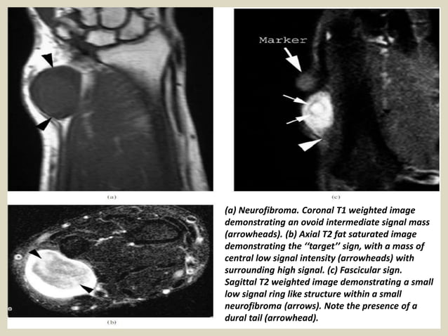 Presentation1.pptx, radiological imaging of soft tissue masses of the ...