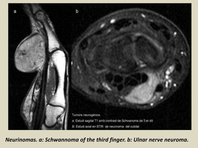 Presentation1.pptx, radiological imaging of soft tissue masses of the ...