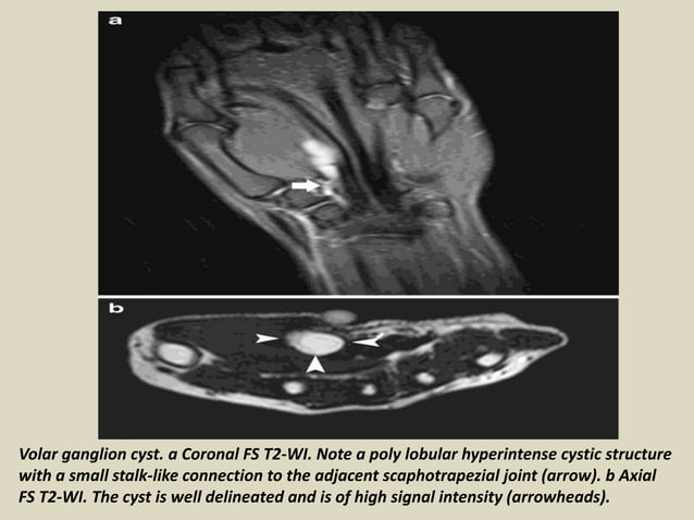 Presentation1.pptx, radiological imaging of soft tissue masses of the ...