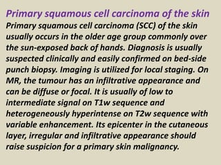 Presentation1.pptx, radiological imaging of soft tissue masses of the ...