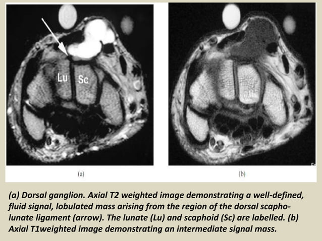 Presentation1.pptx, radiological imaging of soft tissue masses of the ...