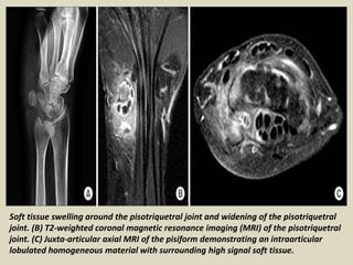 Presentation1.pptx, radiological imaging of soft tissue masses of the ...