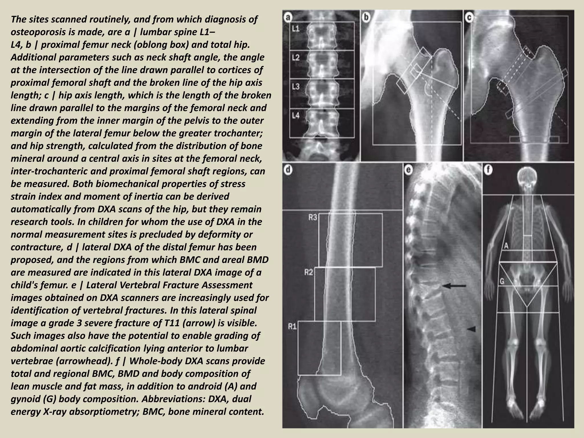 Presentation1.pptx, radiological imaging of metabolic bone diseases. | PPTX | Endocrine and ...