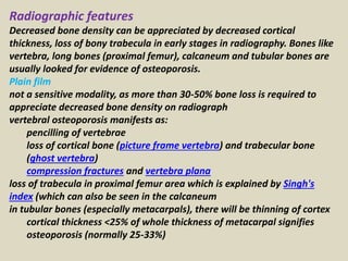 Presentation1.pptx, radiological imaging of metabolic bone diseases. | PPTX