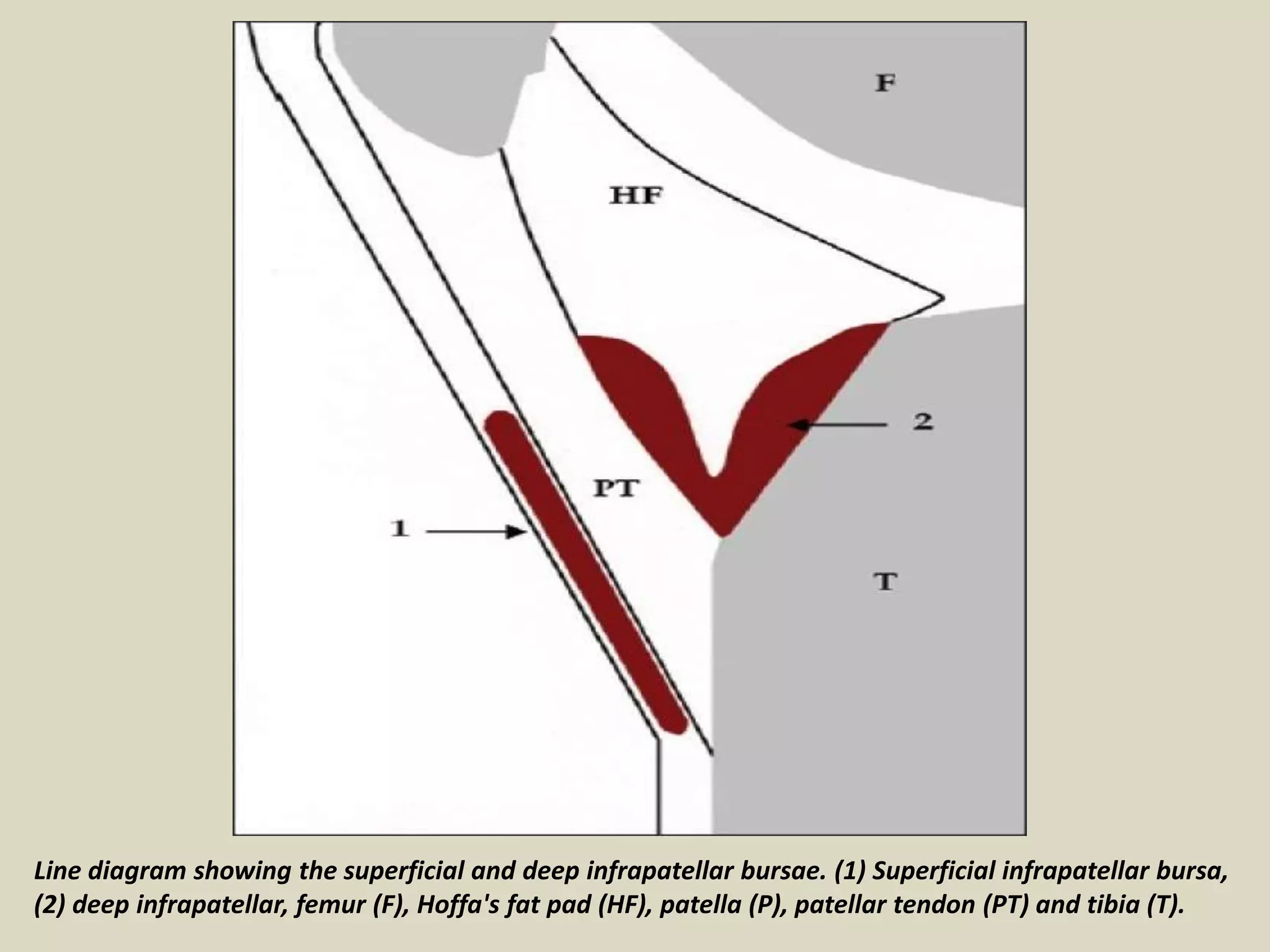 Presentation1.pptx, radiological imaging of bursae. | PPTX