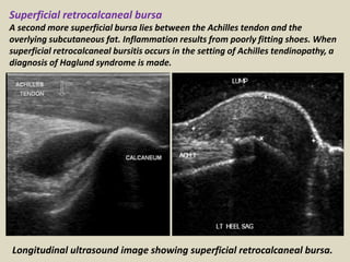 Imaging Of The Bursae Journal Of Clinical Imaging Science