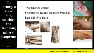 SNAKE BITES IN SRI LANKA | PPTX | First Aid | Injuries