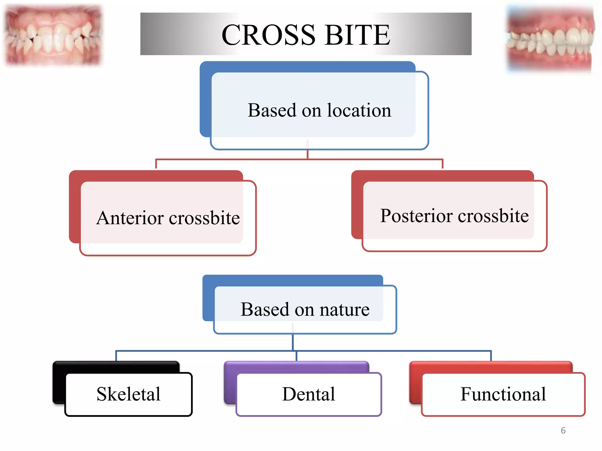crossbite management in restorative dentistry | PPTX