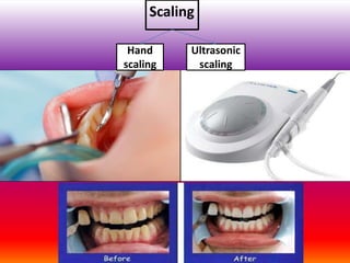 periodontology | PPTX | Dental Health | Diseases and Conditions