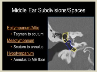 Scutum Temporal Bone