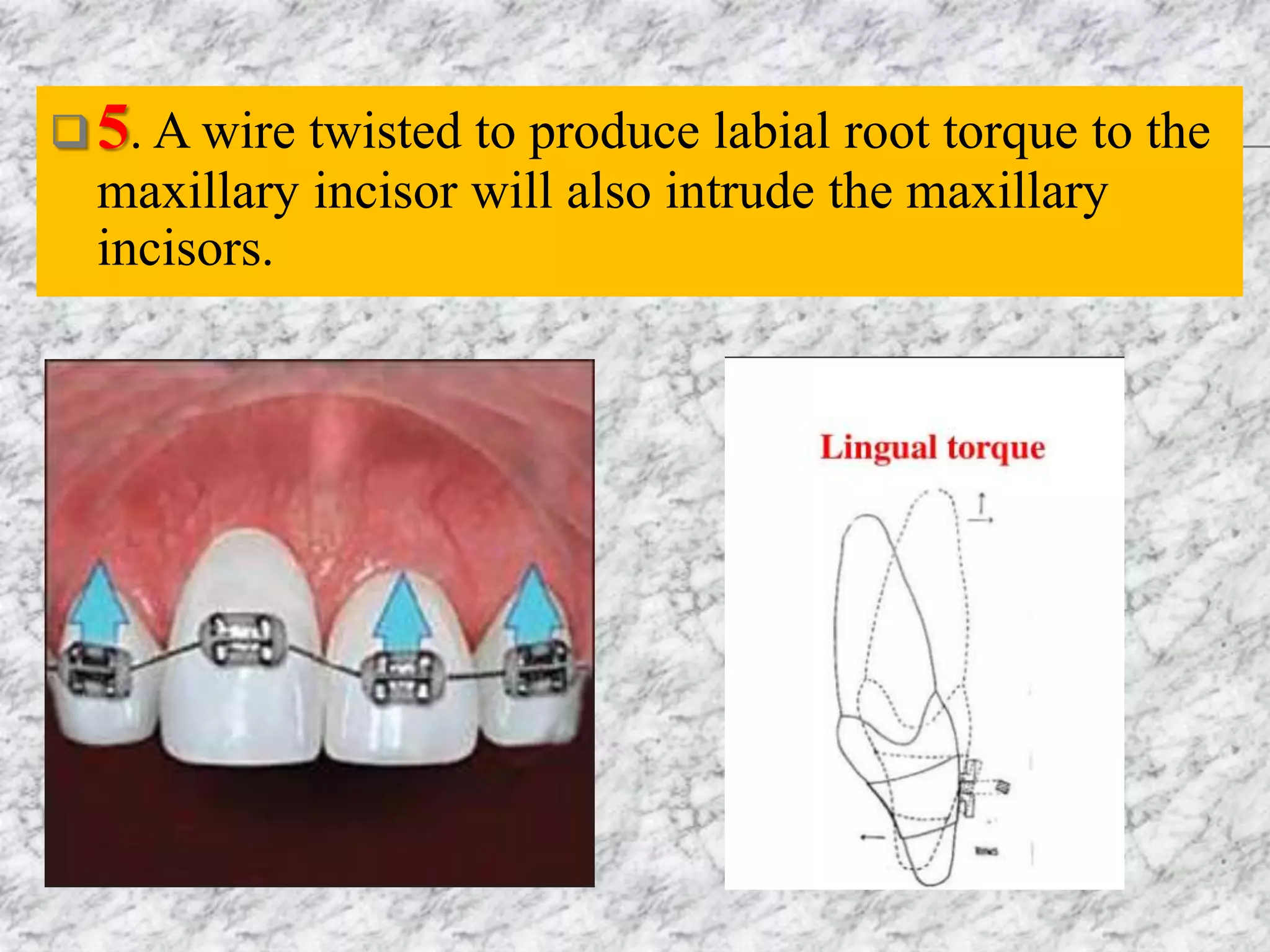 Torque in orthodontics | PPTX