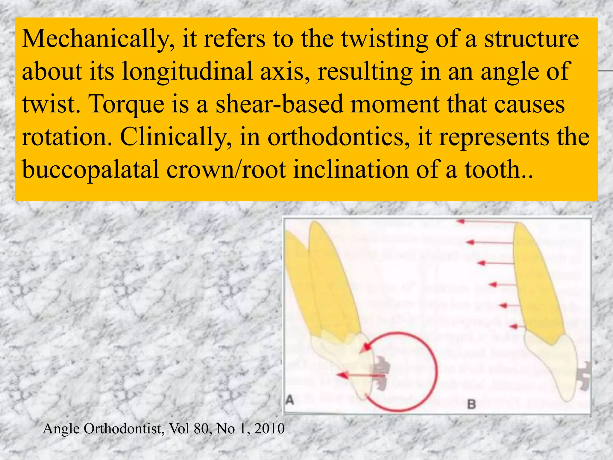 Torque in orthodontics | PPTX
