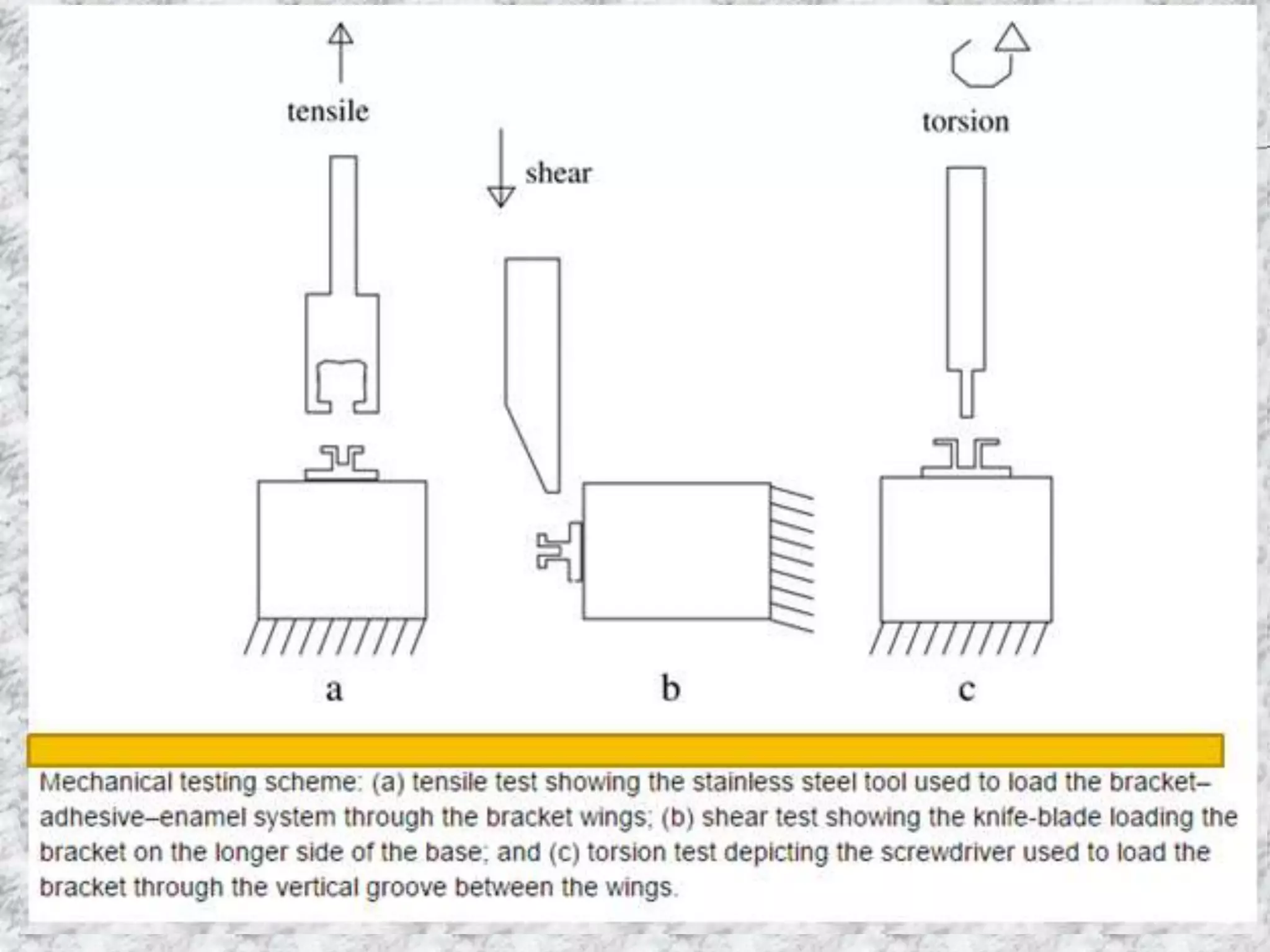 Torque in orthodontics | PPTX