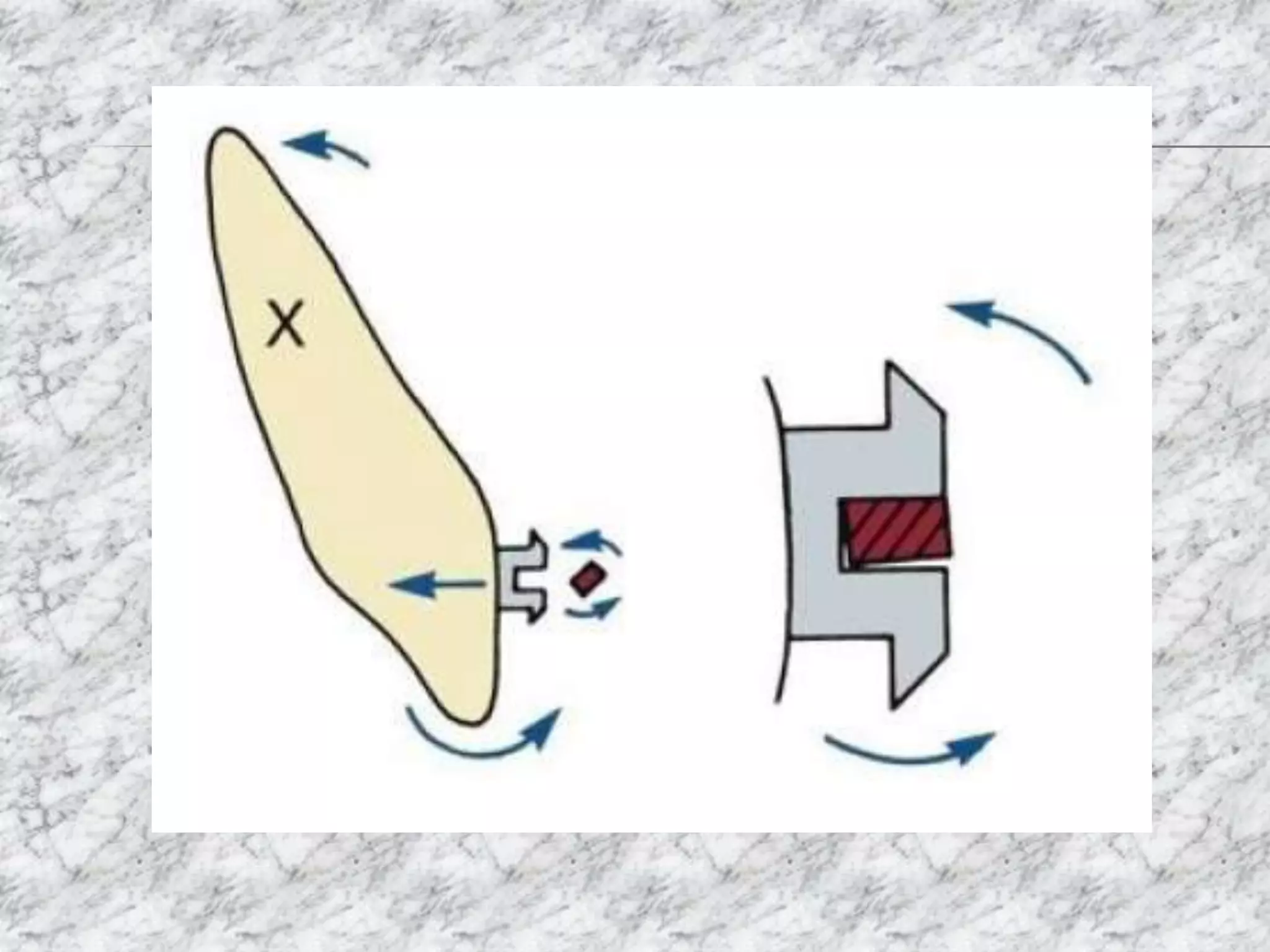 Torque in orthodontics | PPTX