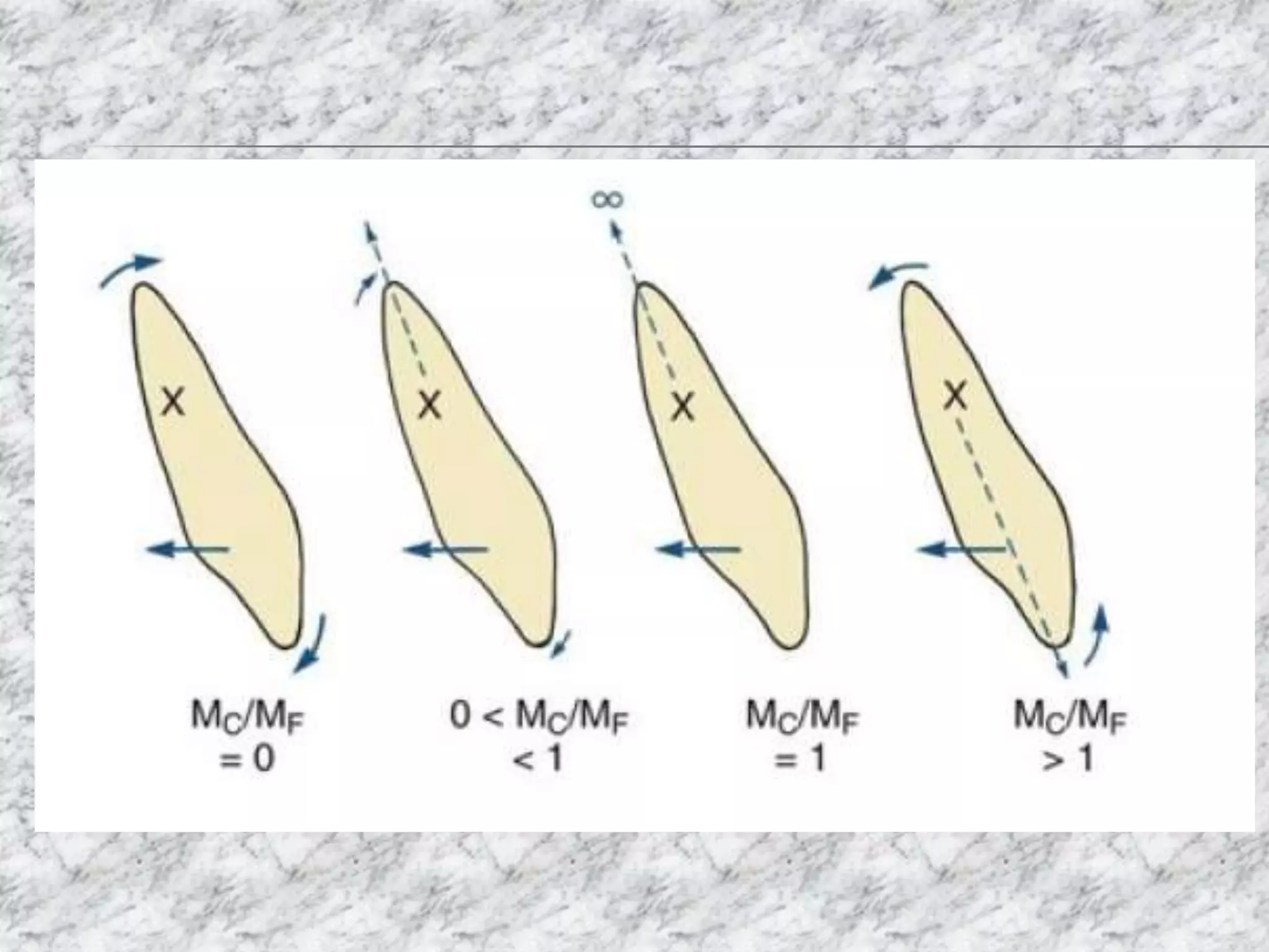 Torque in orthodontics | PPTX
