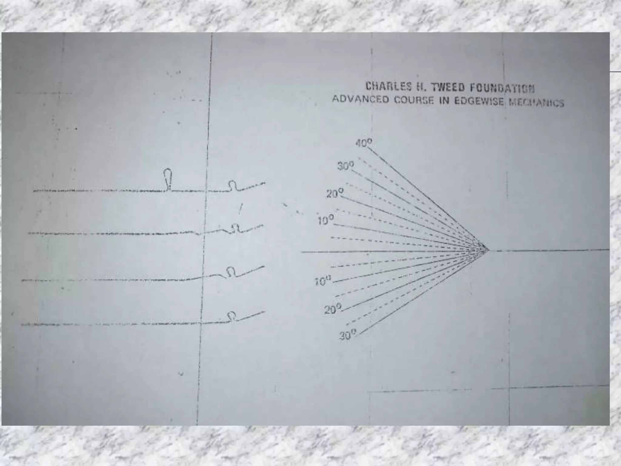 Torque in orthodontics | PPTX