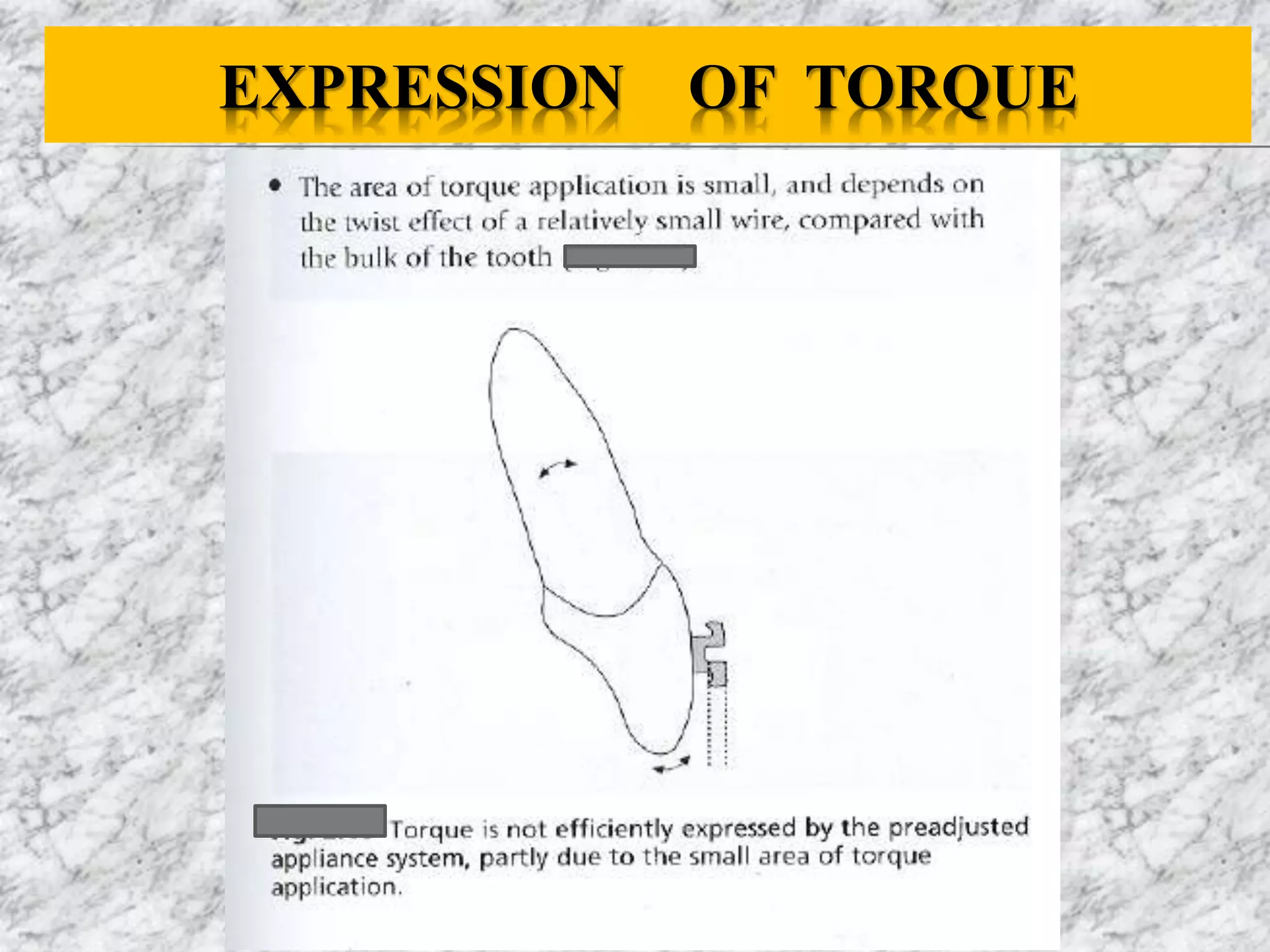 Torque in orthodontics | PPTX