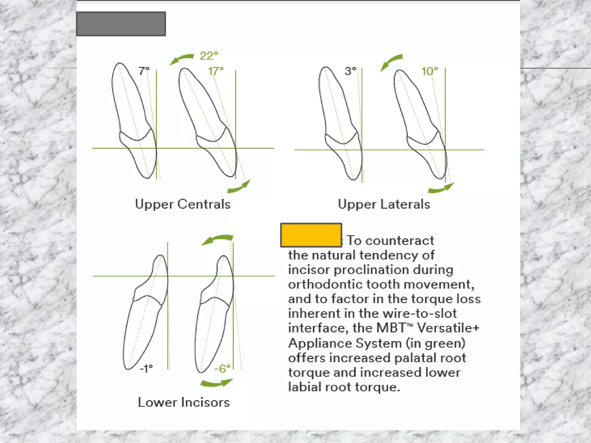 Torque in orthodontics | PPTX