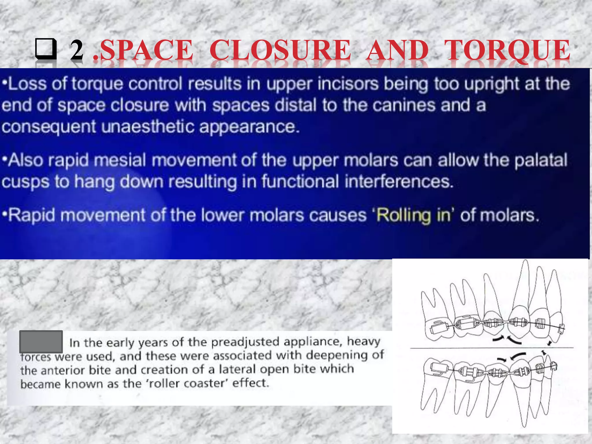 Torque in orthodontics | PPTX