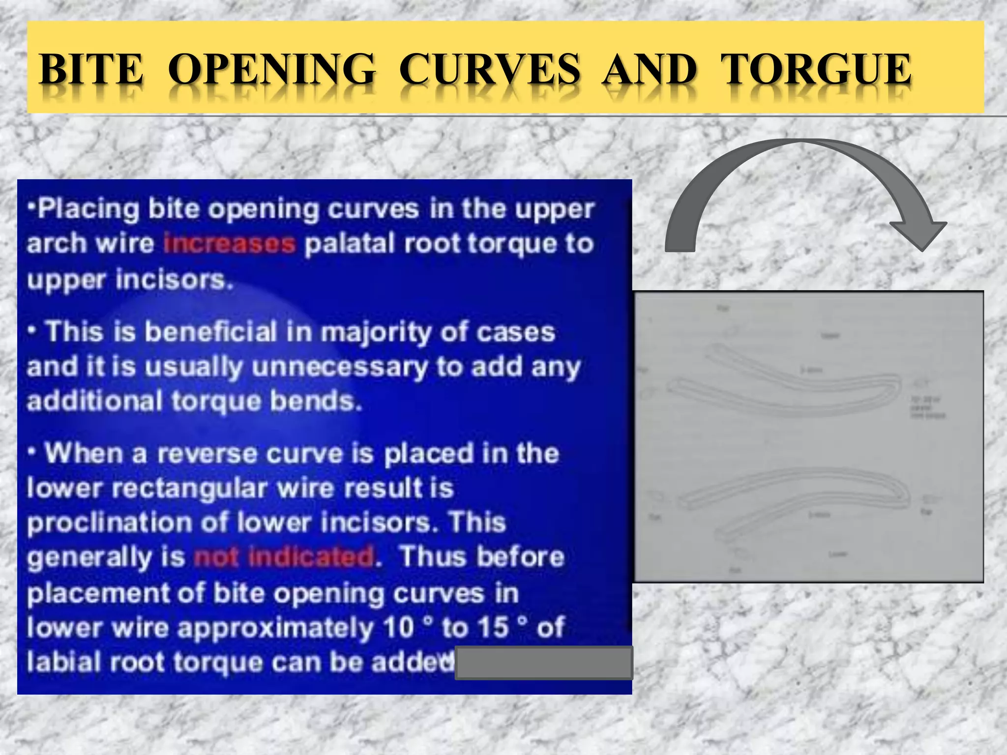Torque in orthodontics | PPTX
