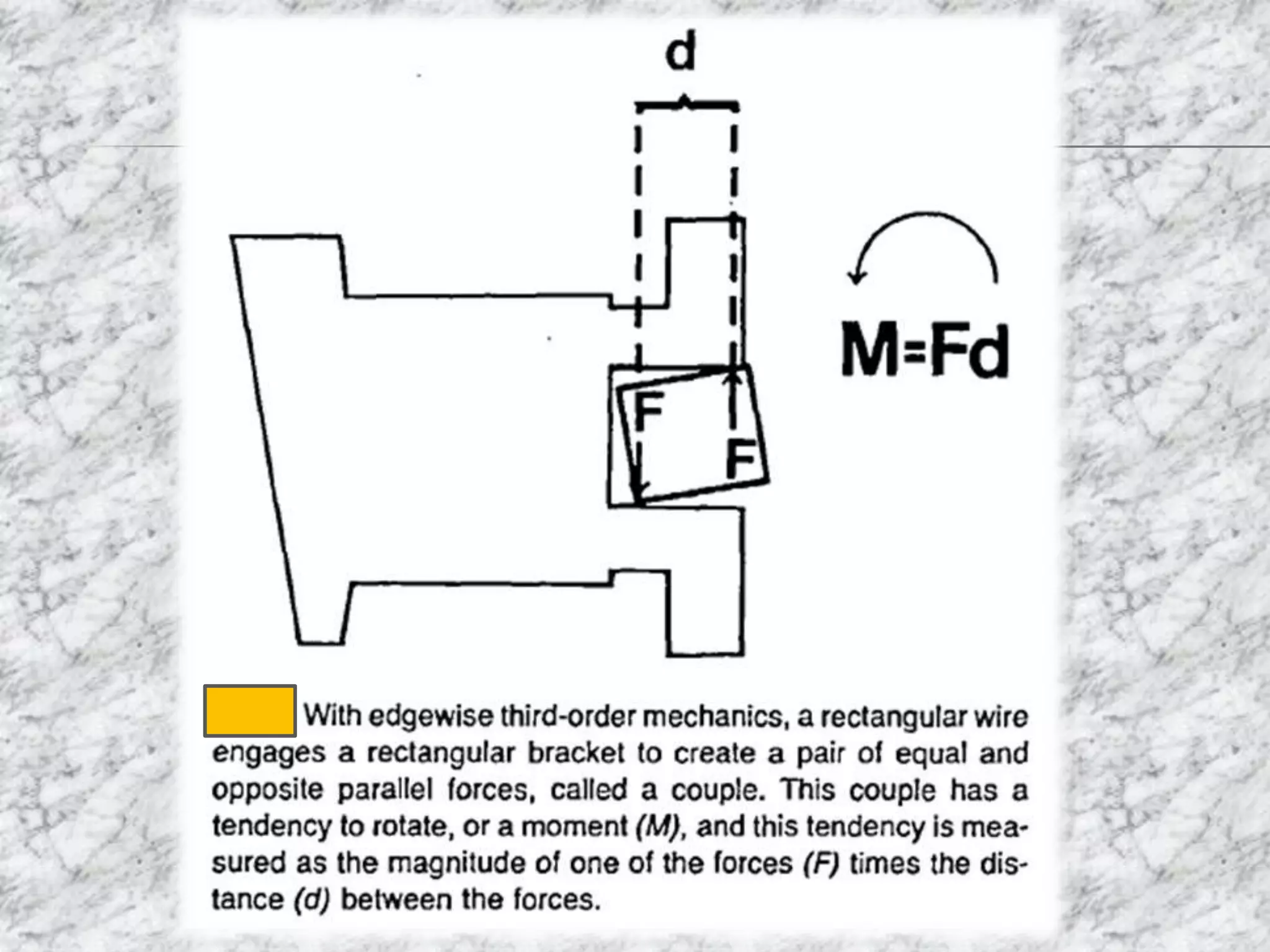 Torque in orthodontics | PPTX