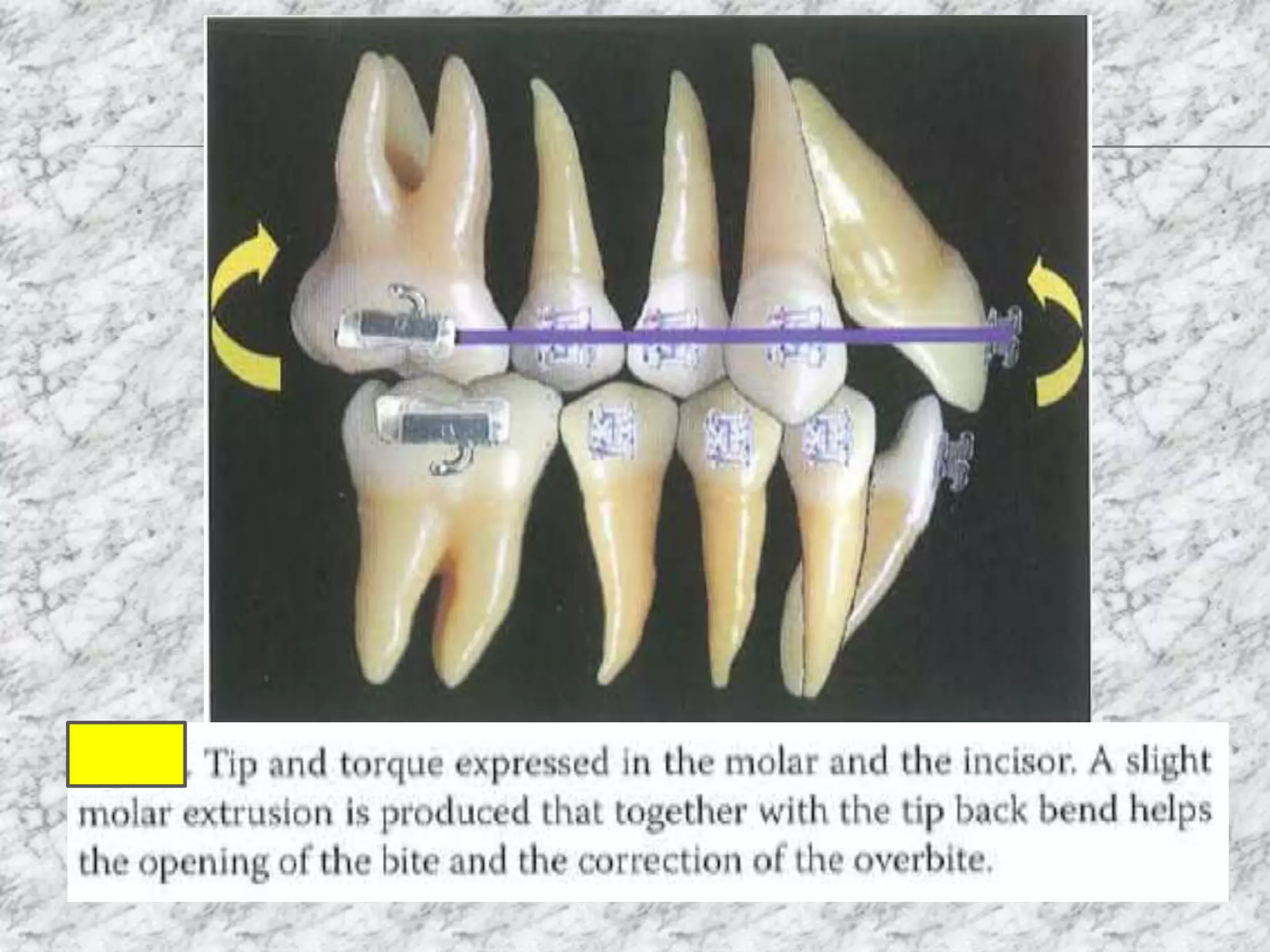 Torque in orthodontics | PPTX
