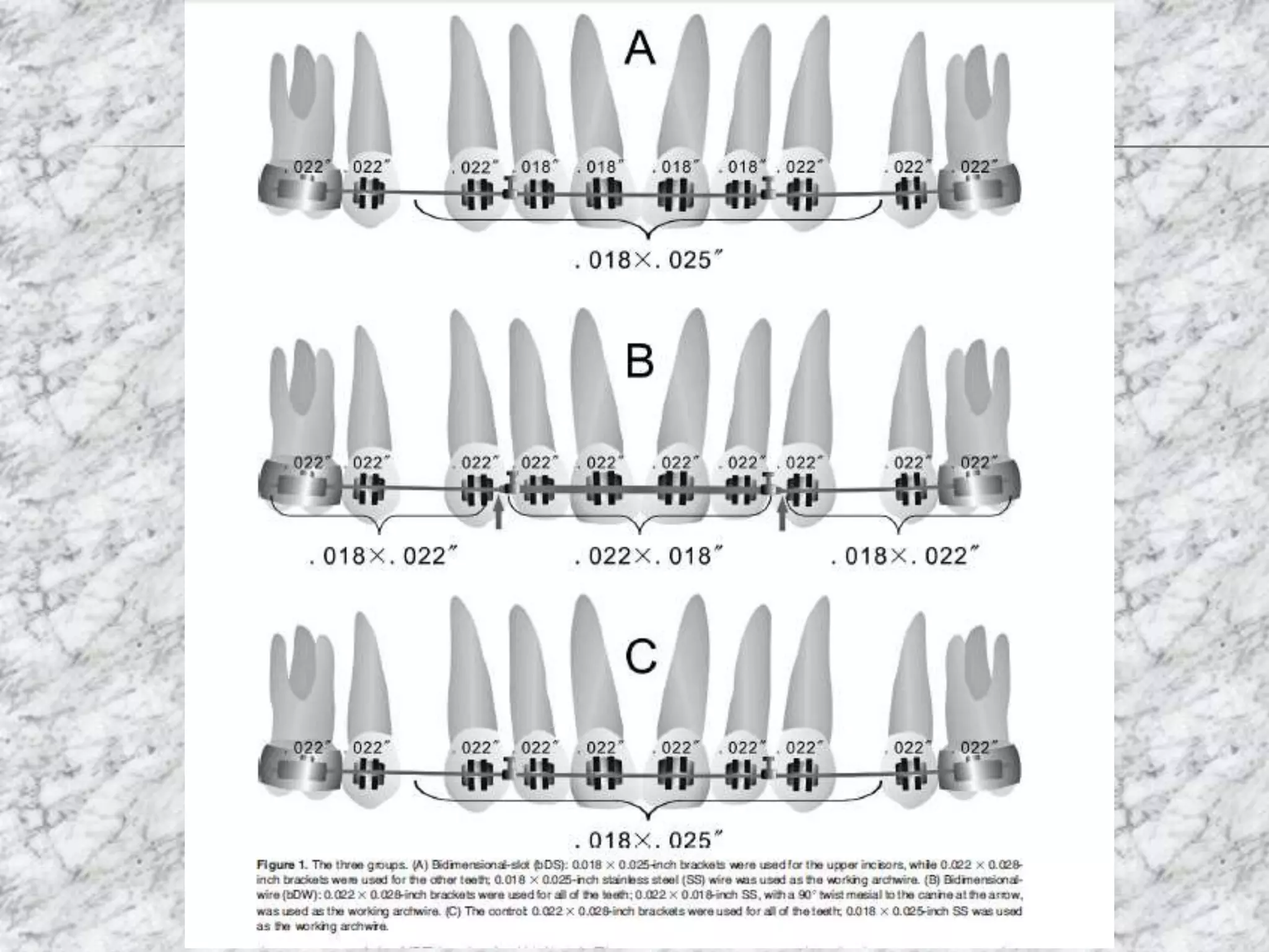 Torque in orthodontics | PPTX