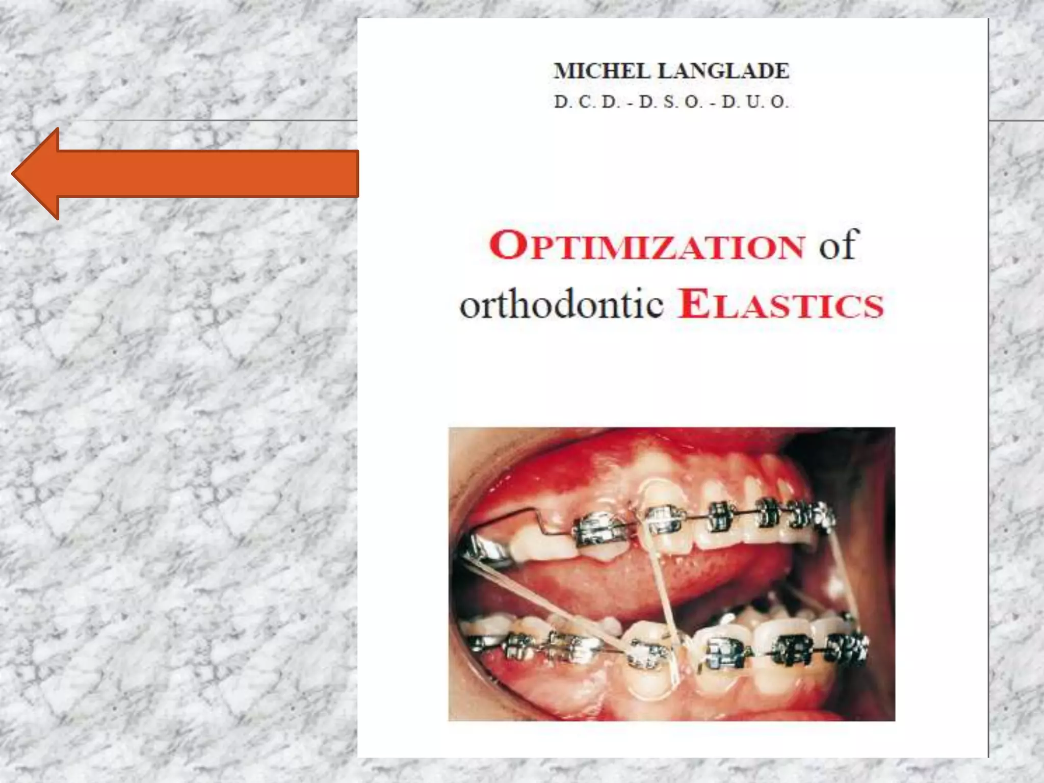 Torque in orthodontics | PPTX