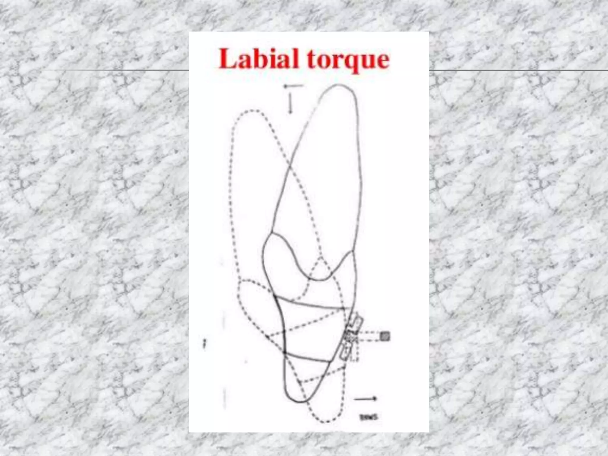 Torque in orthodontics | PPTX