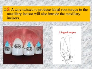 Torque in orthodontics | PPTX