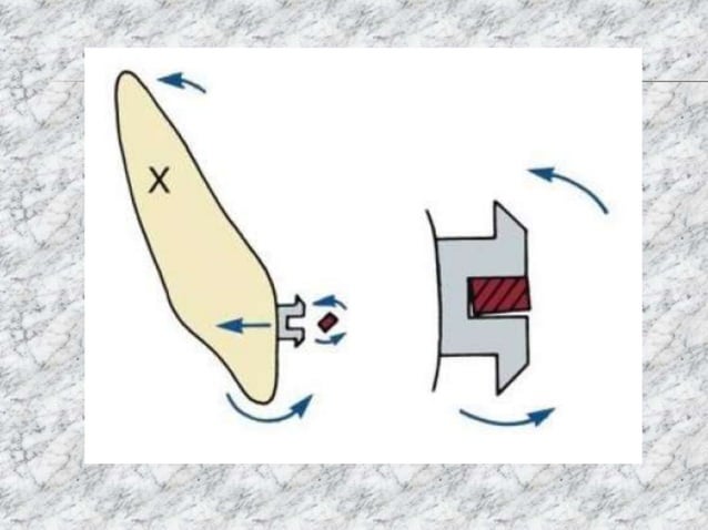 Torque in orthodontics | PPTX