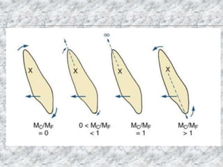 Torque in orthodontics | PPTX