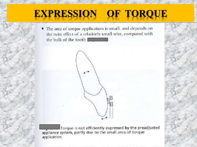Torque in orthodontics | PPTX