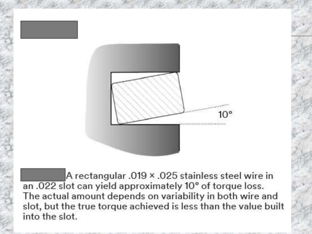 Torque in orthodontics | PPTX