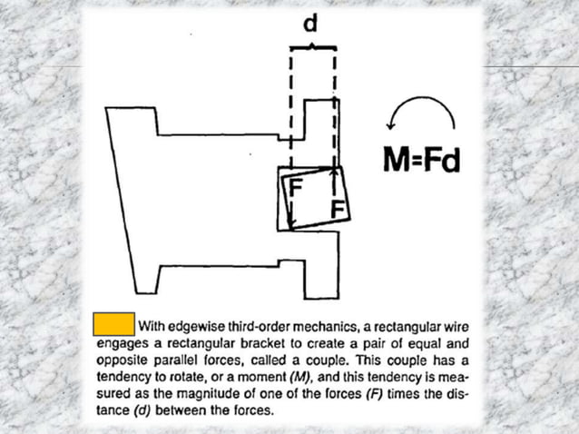 Torque in orthodontics | PPTX