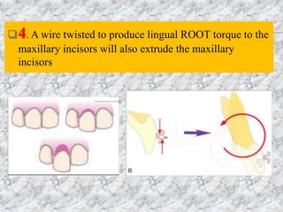 Torque in orthodontics | PPTX
