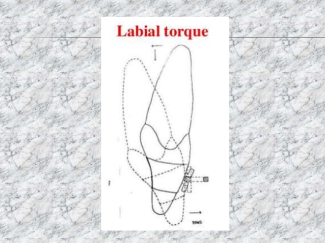 Torque in orthodontics | PPTX