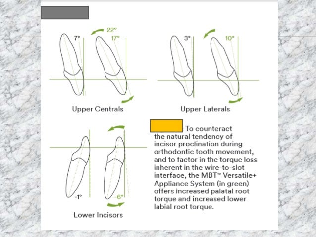 Torque in orthodontics