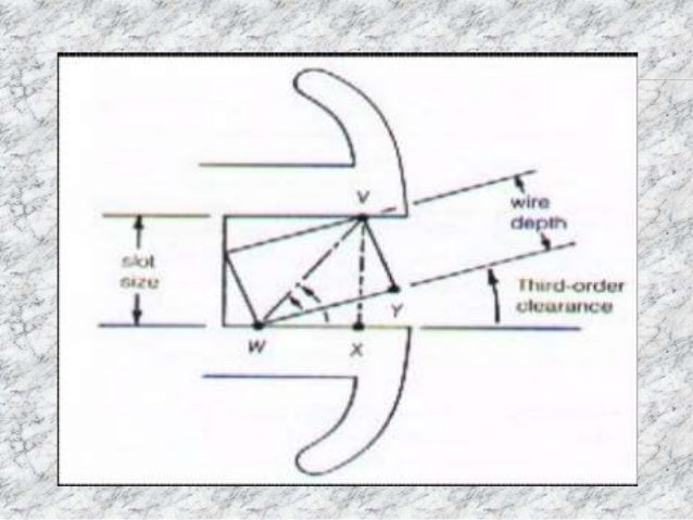 Torque in orthodontics