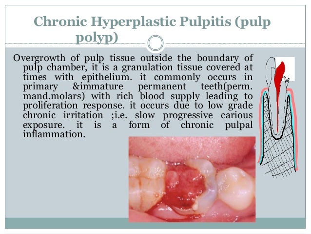 K-Endo-Presentation lec2