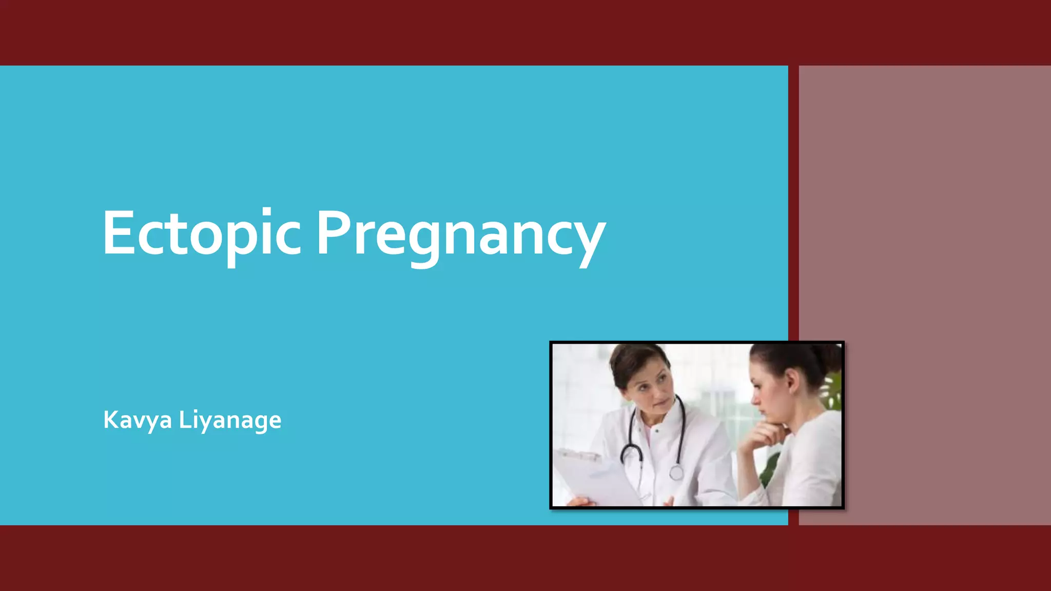 Ectopic Pregnancy | PPTX