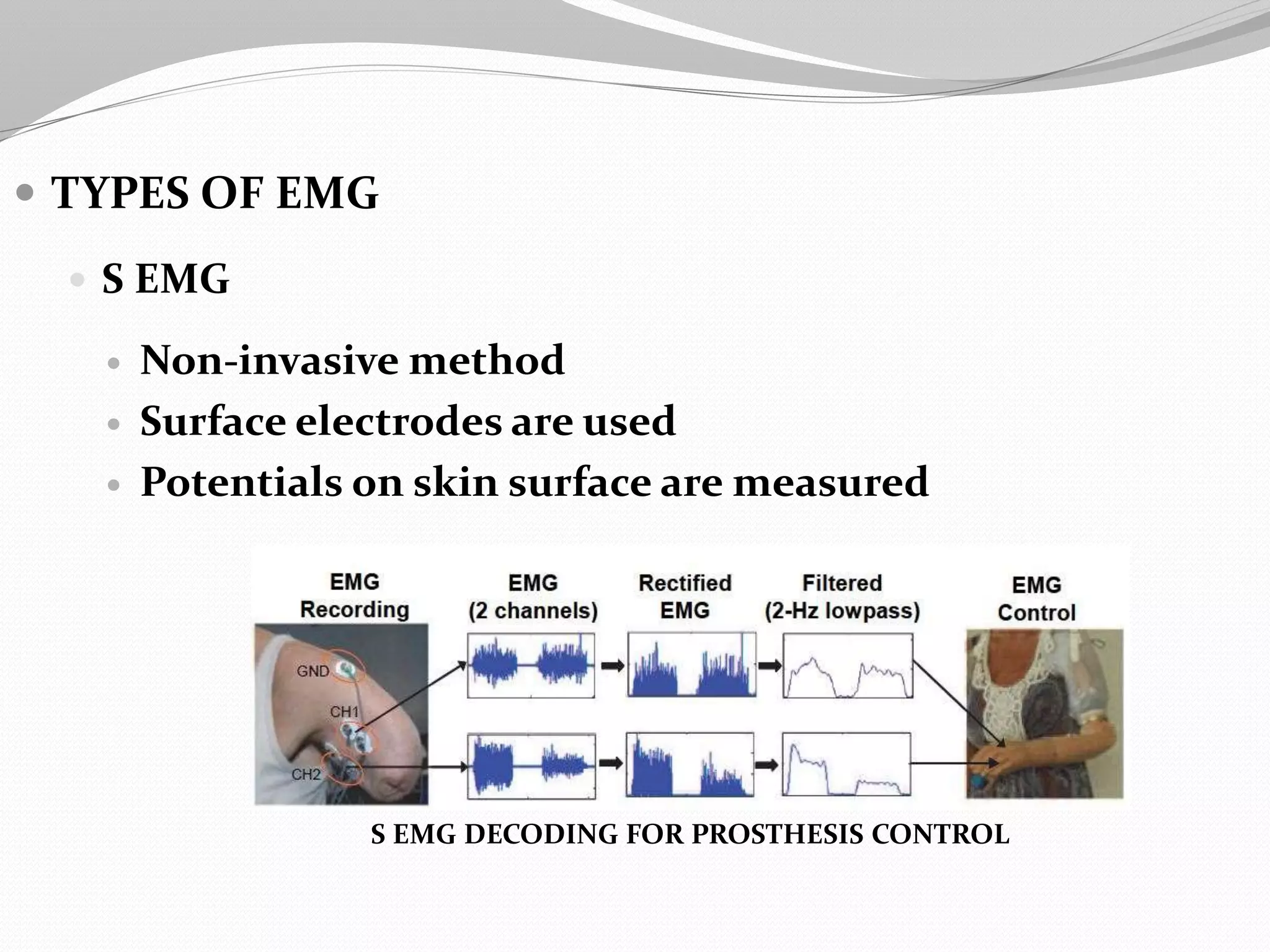 Bioelectric Prosthesis Modelling using 3D-Printing | PPTX