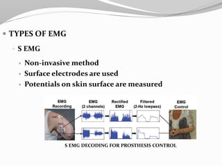 Bioelectric Prosthesis Modelling using 3D-Printing | PPTX