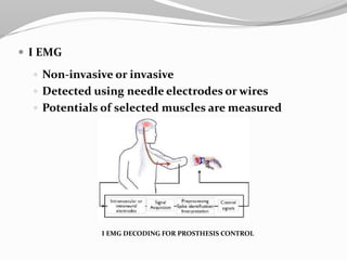 Bioelectric Prosthesis Modelling using 3D-Printing | PPTX